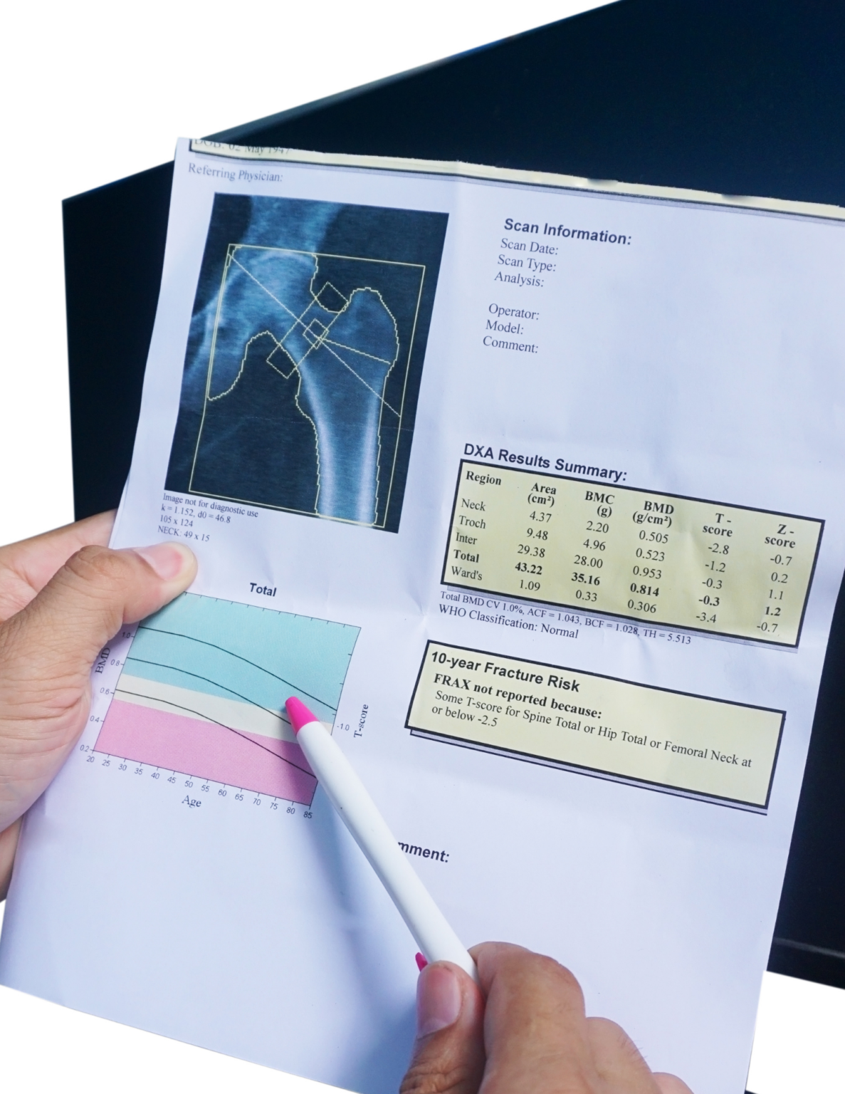 The Crucial Role of DEXA Scans for Women in Perimenopause and Menopause ...